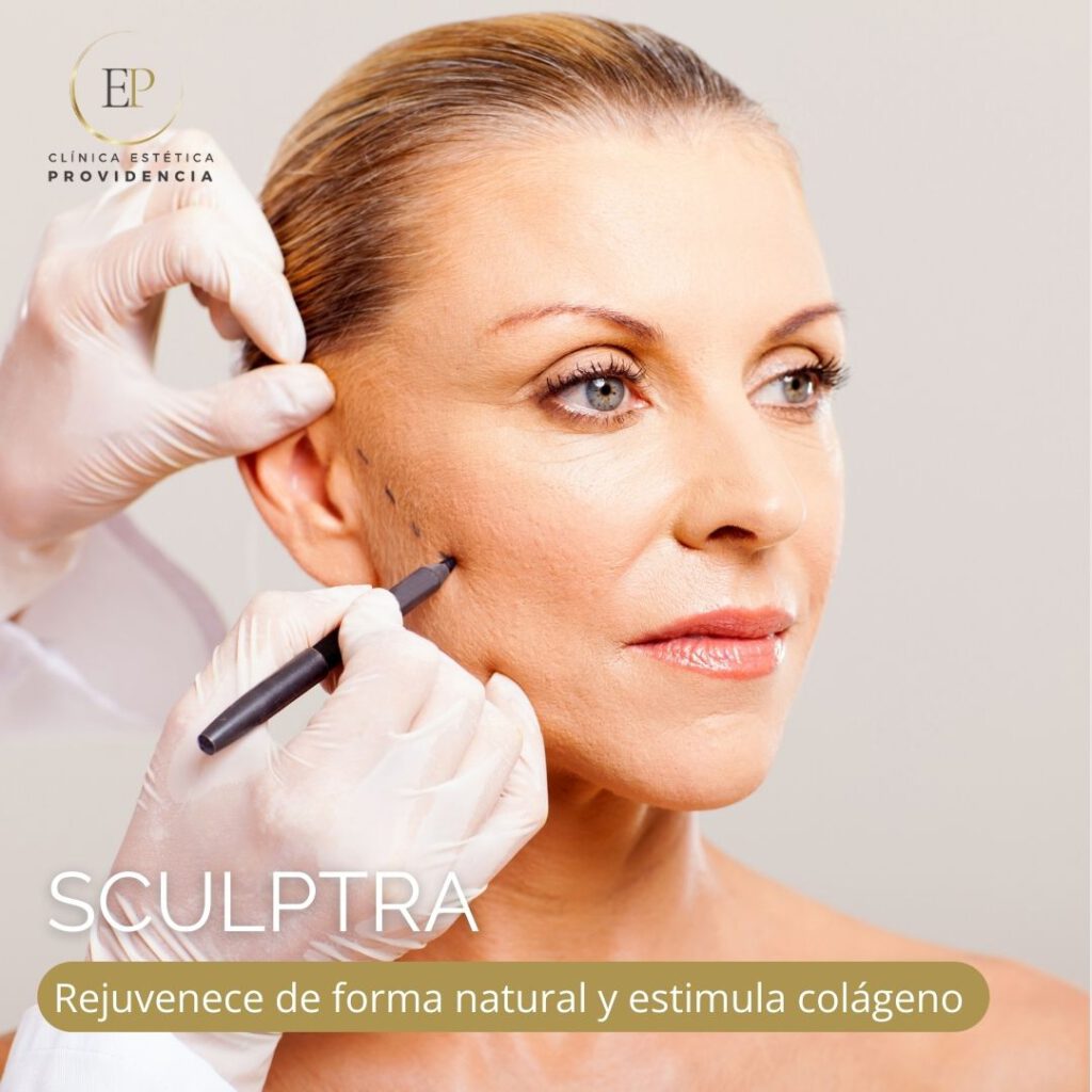 Bioestimulación de colágeno Sculptra (1 vial) - Clínica Estética ...